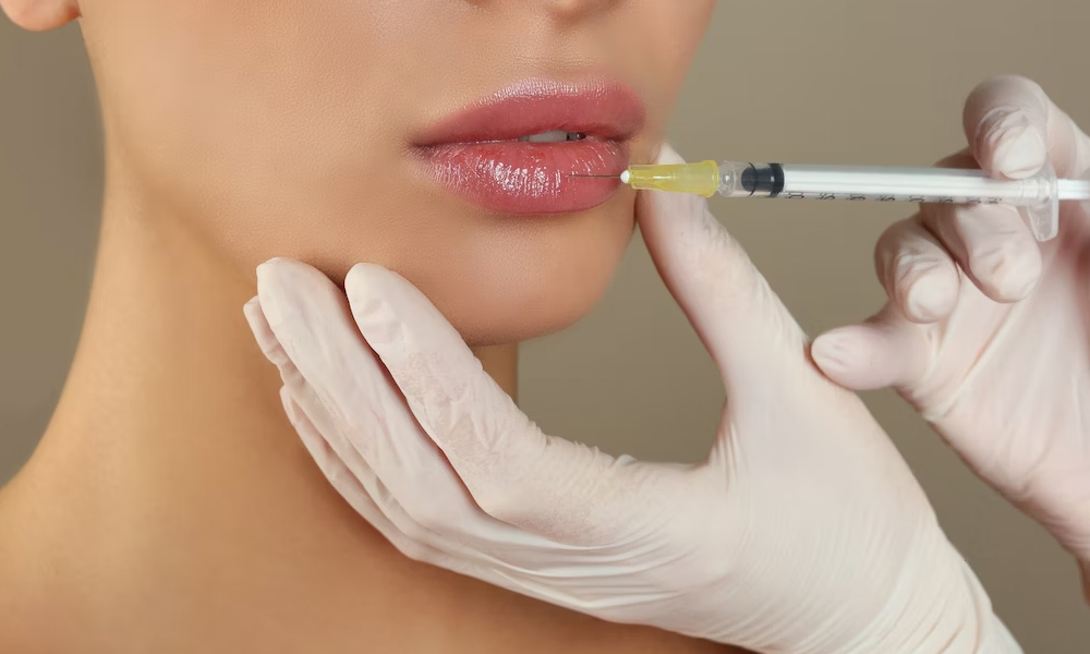 Lip Filler Injection Techniques and Methods in Aesthetic